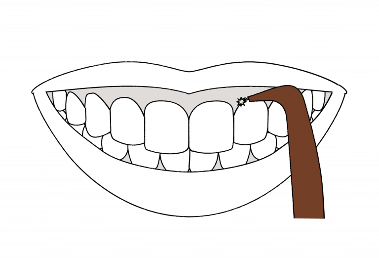 Gum Contouring Treatment in Melbourne | Adawn Dental Studio